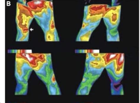 🌿ҮЕ МӨЧНИЙ ҮРЭВСЭЛ ГАЗРЫН ХАСАХ Earthing Mongolia Facebook