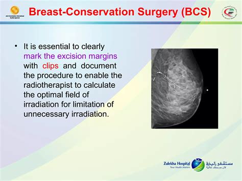 Breast Oncoplastic Surgery Ppt