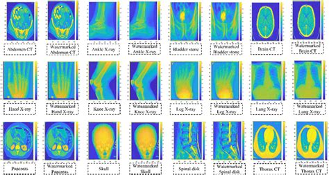 Representation Of Pixel Value Of Input Medical Images And Watermarked Download Scientific