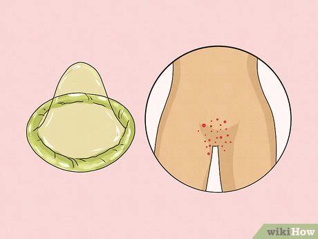 6 Easy Ways To Deal With Soreness After Sex WikiHow