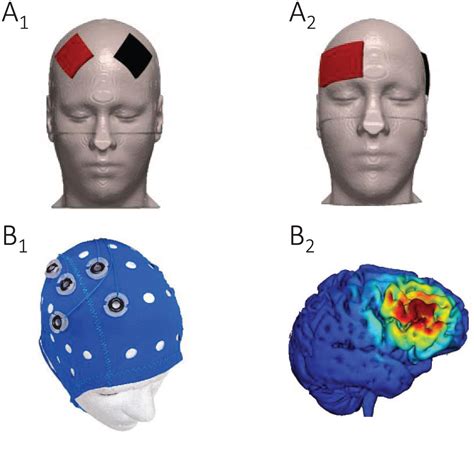 Dorsolateral Prefrontal Cortex Tdcs