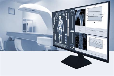 DEXA Scan Singapore Same Day Appointment