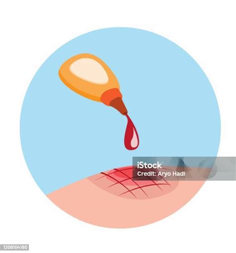 베타딘 에 흉터 요오딘 포비동 액체 에 안티 패혈증 스크래치 피부 기호 만화 플랫 일러스트 벡터 Eps 10 상처에 대한 스톡 벡터 아트 및 기타 이미지 Istock