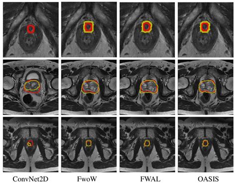 Sample Segmentation Results Of Different Methods The Red And Yellow Download Scientific