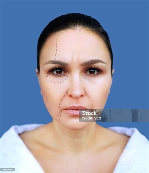 얼굴을 표시 여성 얼굴 성형 수술 개념에 구멍 뚫 기 라인 건강관리와 의술에 대한 스톡 사진 및 기타 이미지 건강관리와 의술
