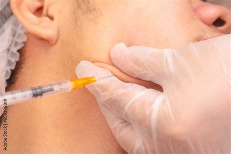 Masseter Jaw Botox Also Known As Jawtox Procedure Close Up View Of A