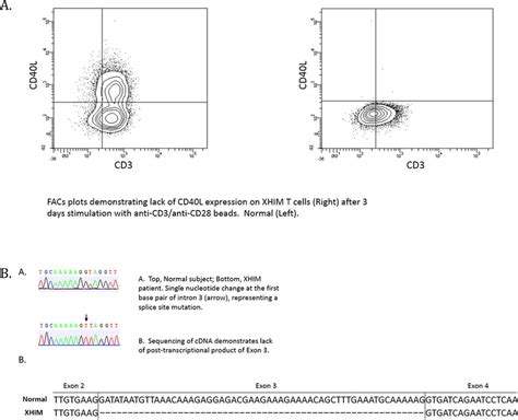 Cd40l Expression On T Cells And Cd40l Gene In The Xhigm Patient And A