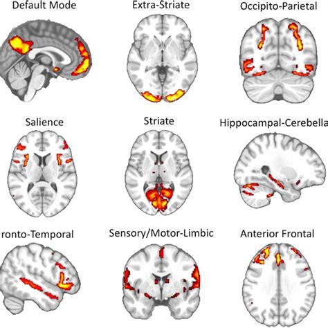Resting State ‘large Scale Networks Identified Via Independent Download Scientific Diagram