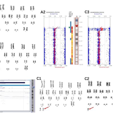 Cytogenetic And Snp Array Results Of The Ssmc Derived From Chromosome