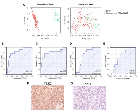 Roc Curve Of Four Specifically Expressed Hub Genes A Principal Download Scientific Diagram