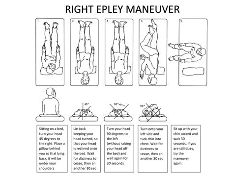 Bppv Resources Vestibular Today