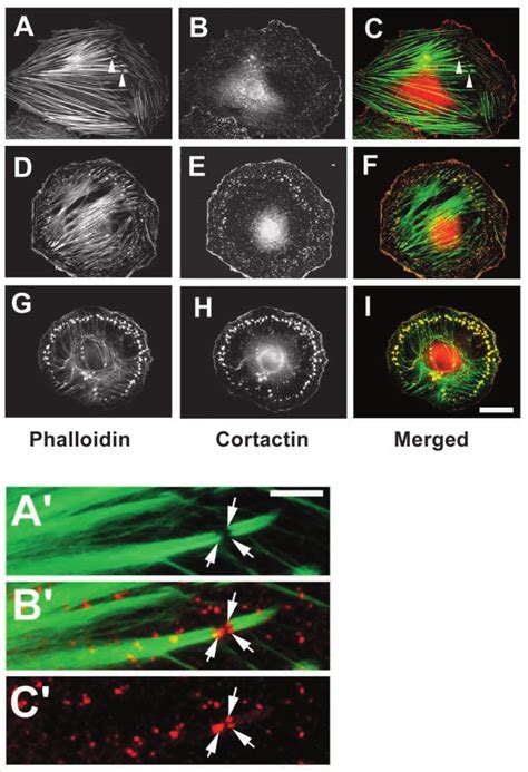 Cortactin Accumulation Precedes Cytoskeletal Remodelling Cortactin