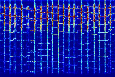 Deep Audio Prior For Blind Sound Source Separation