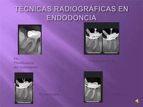 Radiografia En Odontopediatria Y Endodncia Pptx Dental Health