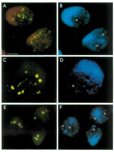 Figure 1 From Different Patterns Of Rdna Organization At