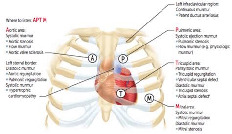 Aortic And Pulmonic Areas