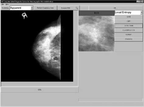 the computer aided diagnostic system for detection segmentation and download scientific