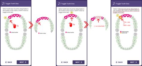 Toggle Tooth Dies Exocad