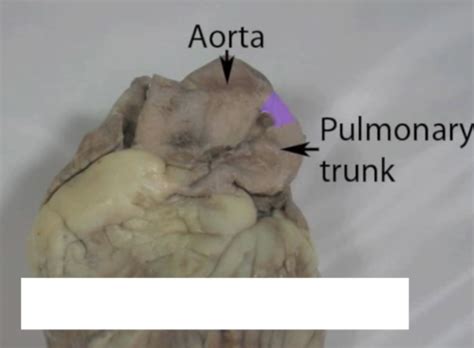 Sheep Heart Lab Aandp2 Flashcards Quizlet
