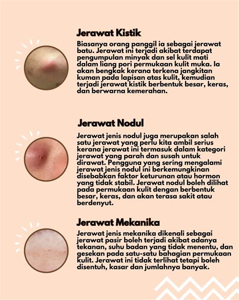 Jenis Jenis Jerawat Carian Lemon8