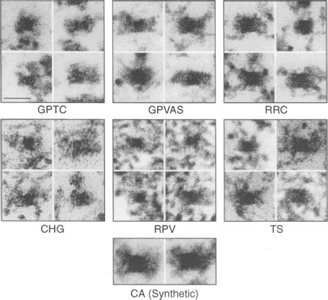 Figure 1 From Myosin Filament Structure In Vertebrate Smooth Muscle Semantic Scholar