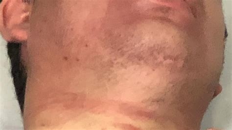 ‘miscarriage Of Justice Carer Wins Retrial In Strangulation Case