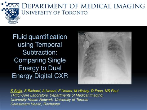 Pdf Fluid Quantification Using Temporal Subtraction Comparing Single