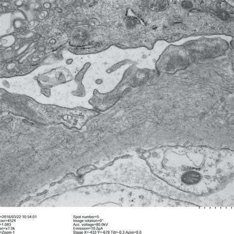 Transmission Electron Microscopy Of Glomerular Basement Membrane With Download Scientific