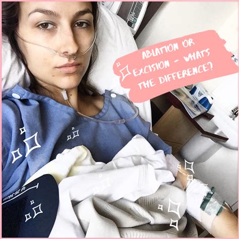 Endometriosis Surgery Excision Vs Ablation All About Annie