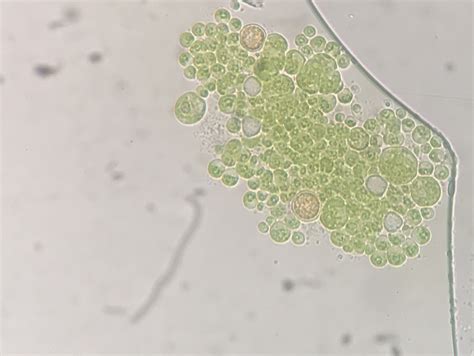 Can Anyone Help Me To Identify This Microalgae With Its Morphology