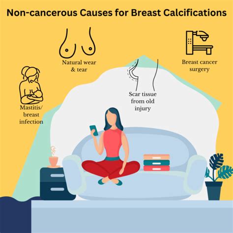 Breast Calcifications What You Should Know Breast Cancer Conqueror