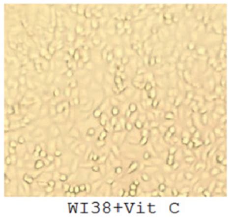 Photomicrograph Of Group Iii Showed Cells Are Fusiform In Shape With