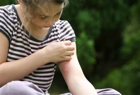 What Does A Tick Bite Look Like Welzo