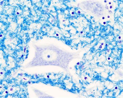 Filespinal Cord Histology 06 Embryology