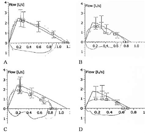 Spirometry Flow Curves At William Deas Blog
