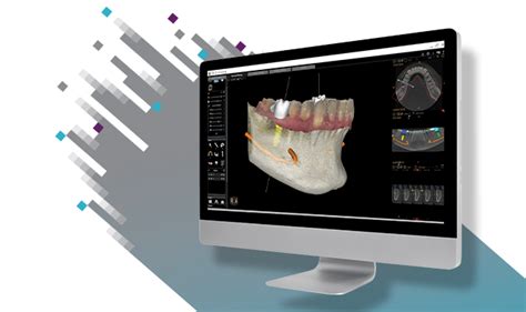 Cs 3d Imaging Software