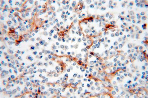 Hla Class I Hla C Antibody 15777 1 Ap Proteintech