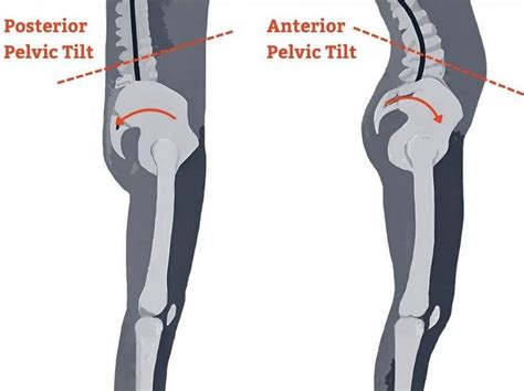 Долмалин Хүнд ачааны нөлөөгөөр машины нум тэгширдэг шиг Хүнд ачаалалтай ажиллаж амьдрахад