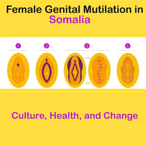 Female Genital Mutilation In Somalia Culturea And Health 2025