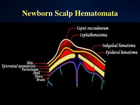 PPT Newborn Examination PowerPoint Presentation Free Download ID 9514612