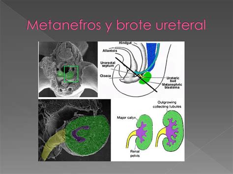 Ppt Desarrollo Del Sistema Urinario Powerpoint Presentation Free Download Id 1810921