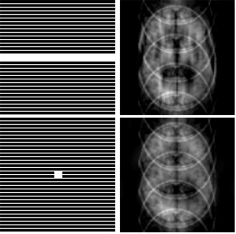 Open Access An Image Space Approach To Cartesian Based Parallel Mr