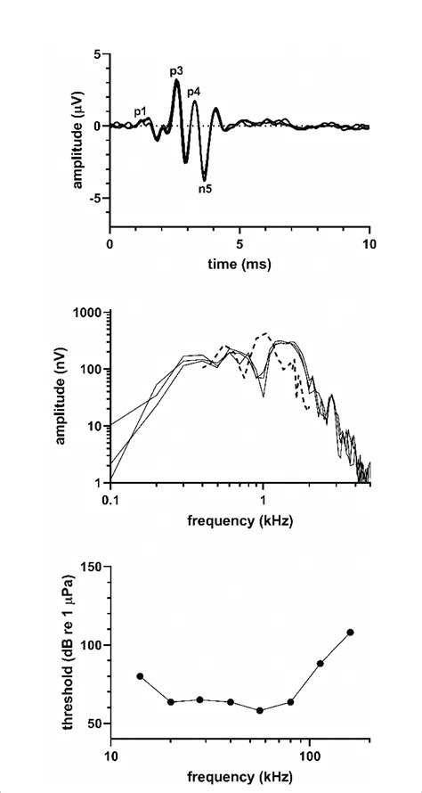 Top Click Evoked Abr Middle Frequency Spectrum Of The Abr Waveform Download Scientific