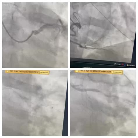 Augusto Daige On Linkedin Catrx