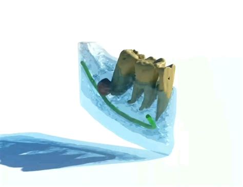 Zibran Khan On Linkedin Slicer3d Blendercommunityindia Blender3d Dental Anatomy…