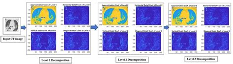 Generalized Block Diagram Of The Data Augmentation Using Wavelet Download Scientific Diagram