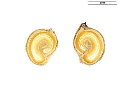 Tmi Smear Slides Tags