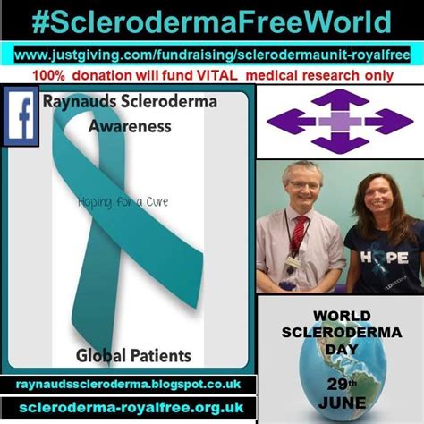 Scleroderma Causes Skin Cancer And Other Dermatology Problems