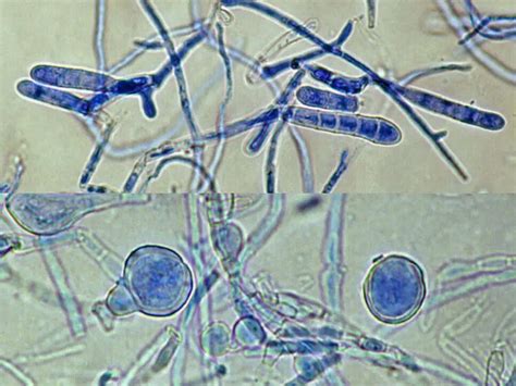 Epidermophyton Floccosum Biology Notes Online