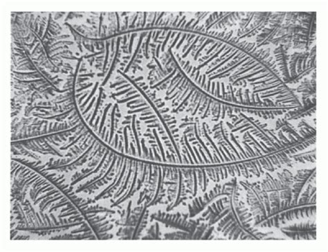 Normal Vaginal Deliveries Obgyn Key